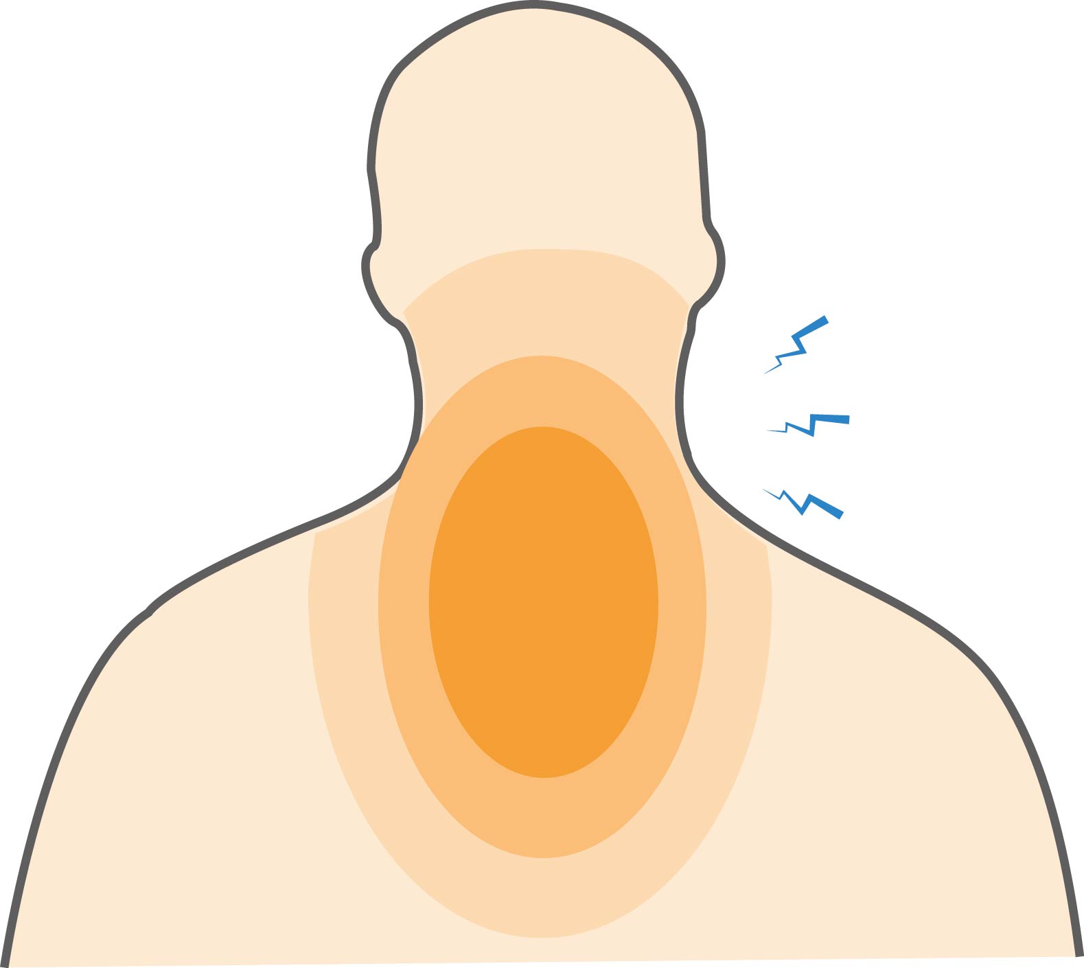 What Are Cervical Strain Injuries How To Identify Them 56 OFF What Are Cervical Strain Injuries How To Identify Them 56 OFF